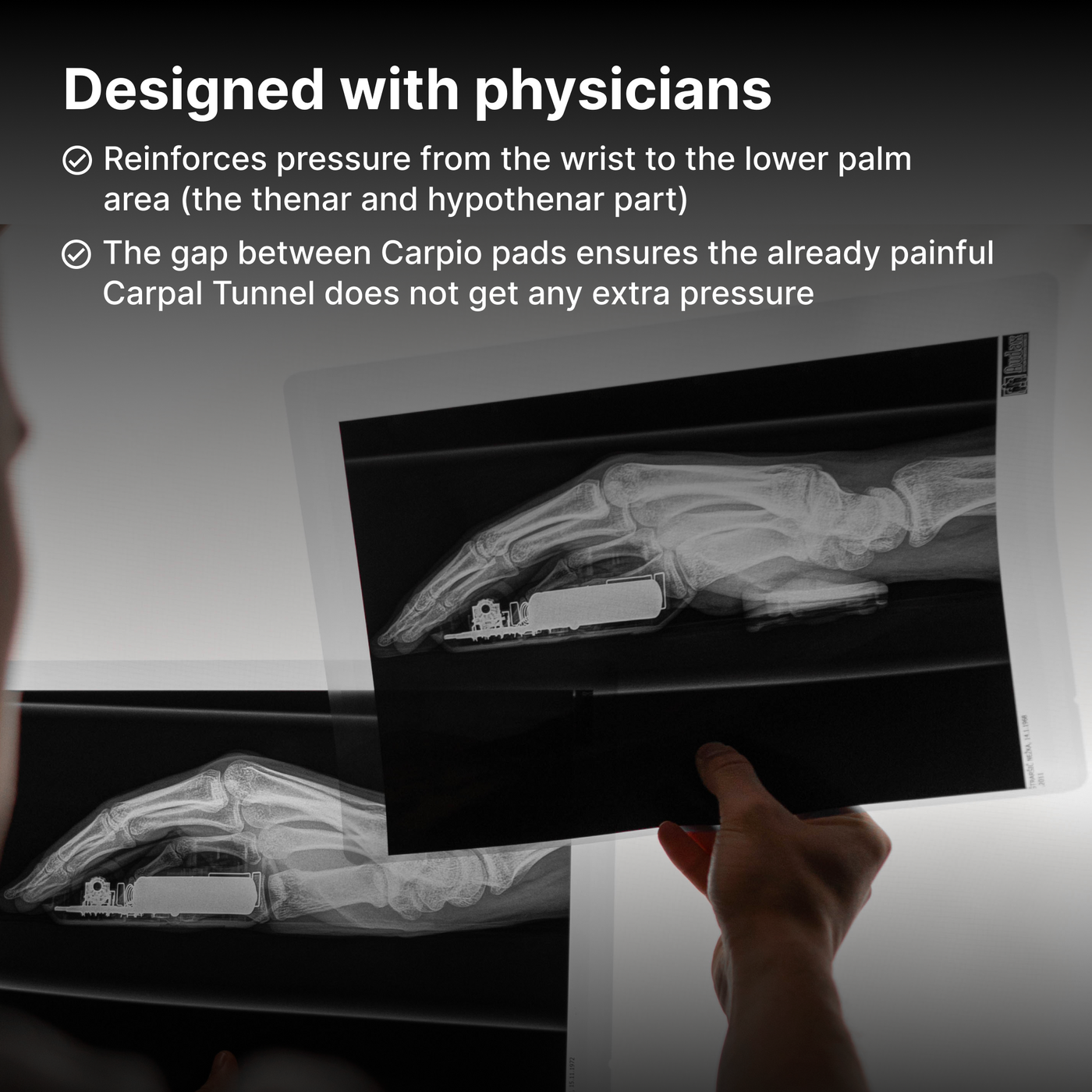 Full Ergonomic Setup - DeltaHub