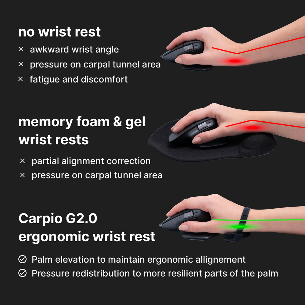 G2.0 Randomfrankp - Gaming Wrist Rest - DeltaHub